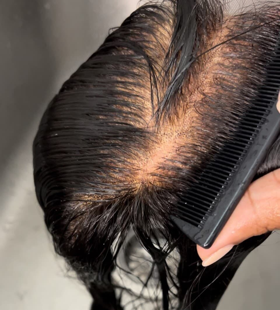 Cranial Prosthesis Certification: Your Path to Expertise
